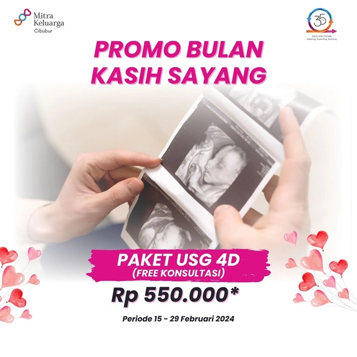 Promo USG 4D Spesial Bulan Kasih Sayang di Mitra Keluarga Cibubur