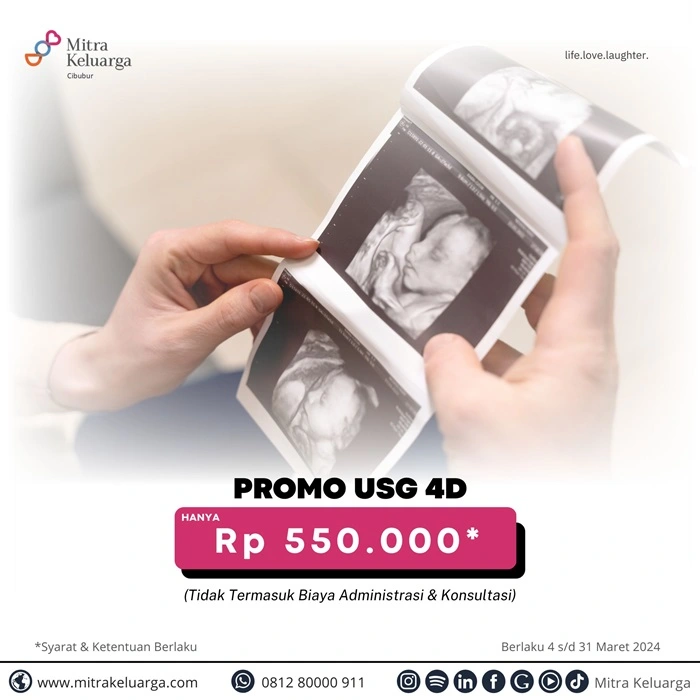 Promo USG 4D Mitra Keluarga Cibubur. Hanya Rp550 Ribu!