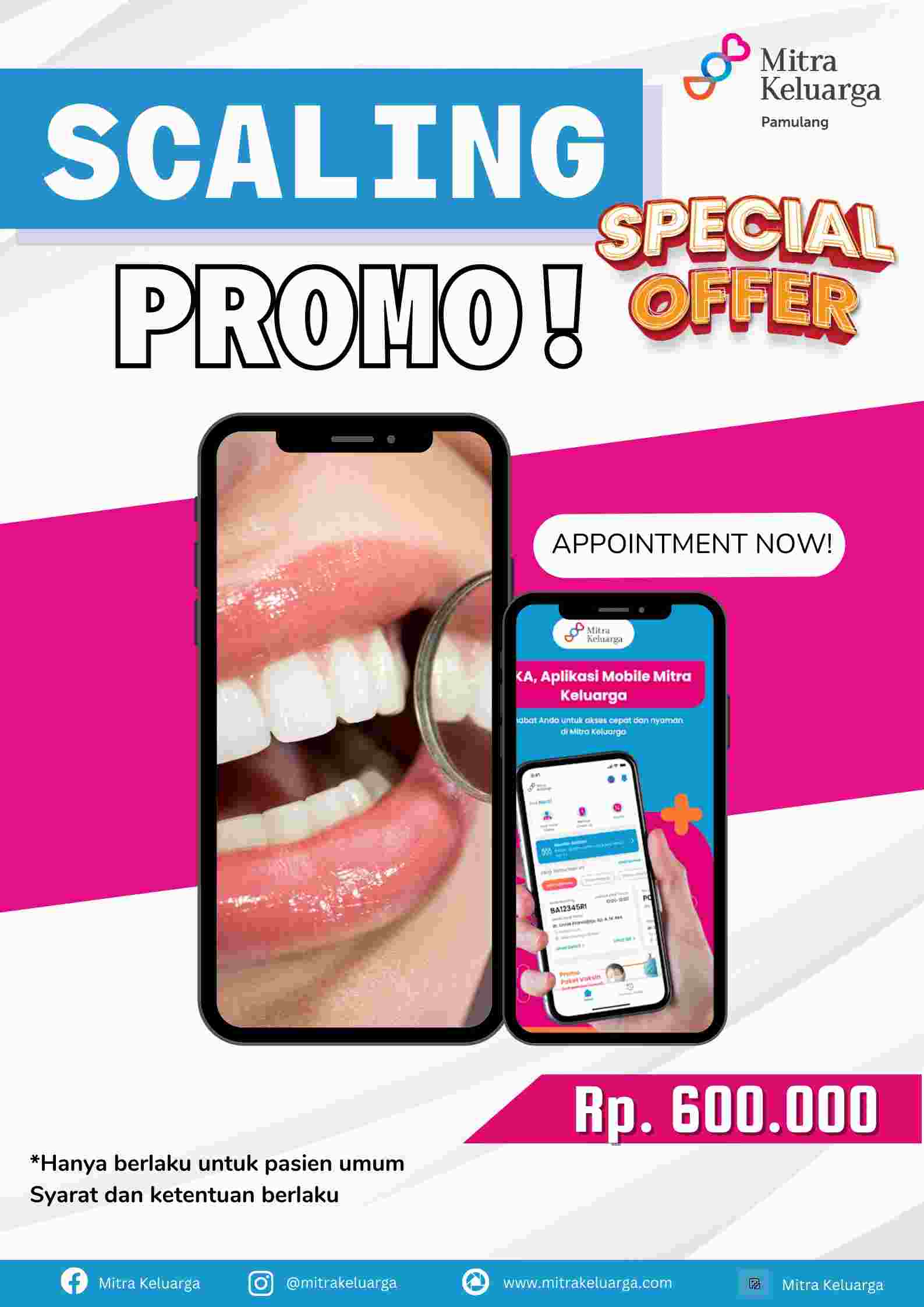 Jaga Gigi Tetap Besih dan Sehat dengan Promo Scaling Gigi Rp600 Ribu di ...