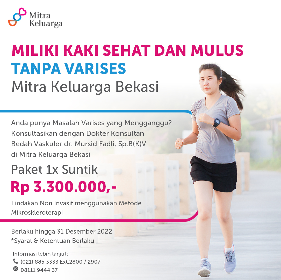 Promo Suntik Varises Mitra Keluarga Bekasi